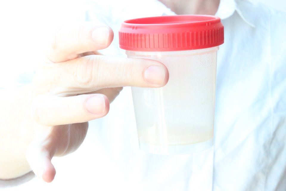 Getting Pregnant Through Sperm Donation